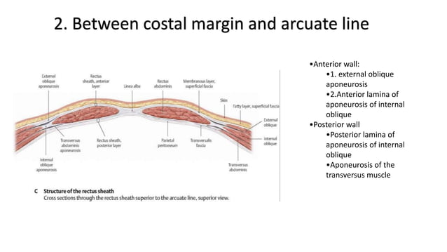 Rectus Sheath anatomy.pptx