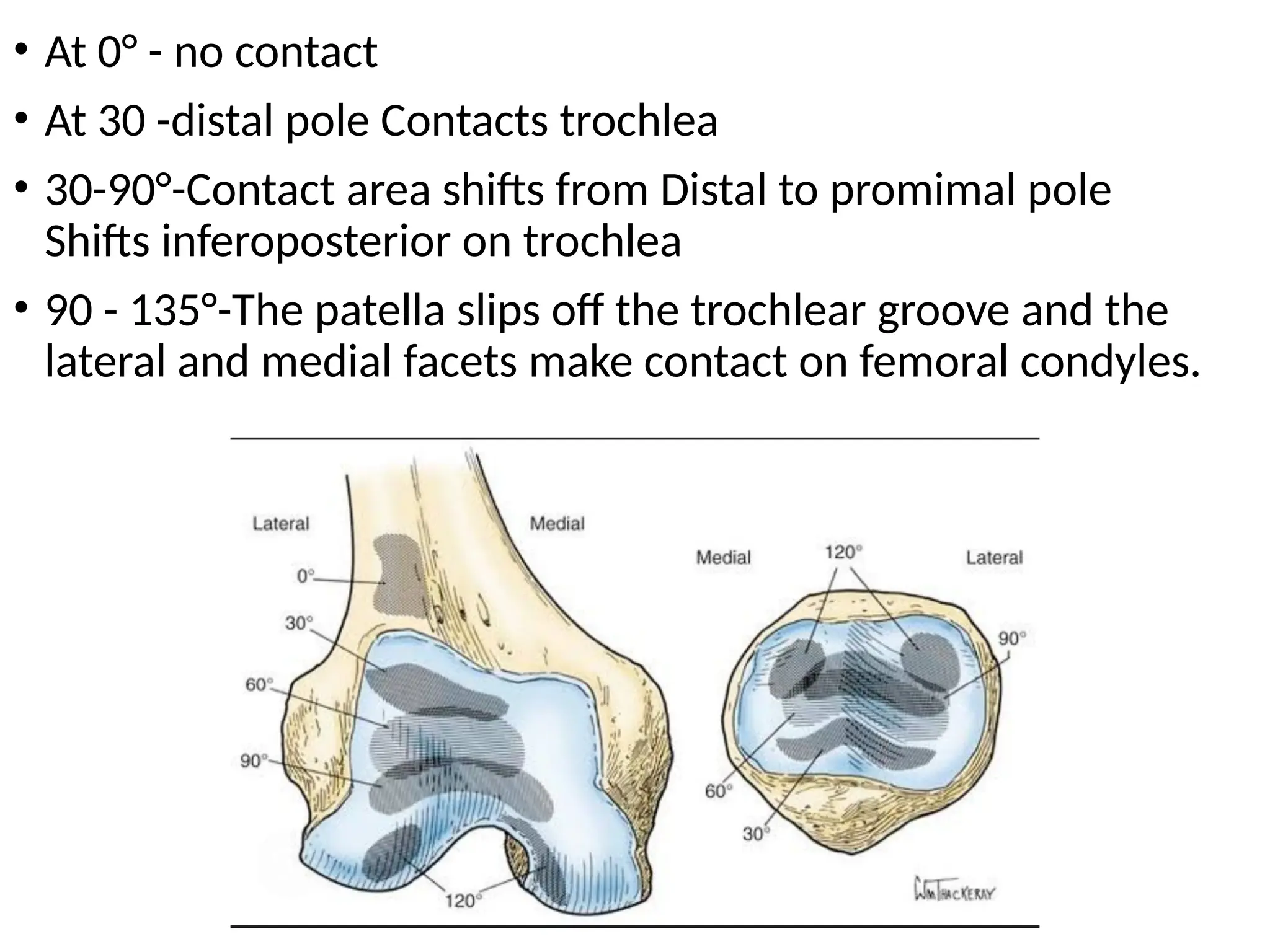 RECURRENT PATELLA DISLOCATION AND MPFL REPAIR.pptx