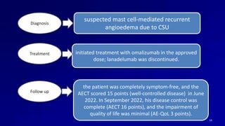 recurrent angioedema.pptx