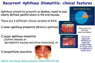 Recurrent aphthous stomatitis | PPTX