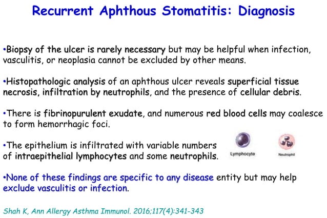 Recurrent aphthous stomatitis | PPTX