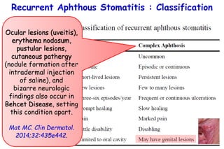 Recurrent aphthous stomatitis | PPTX