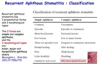 Recurrent Aphthous Stomatitis