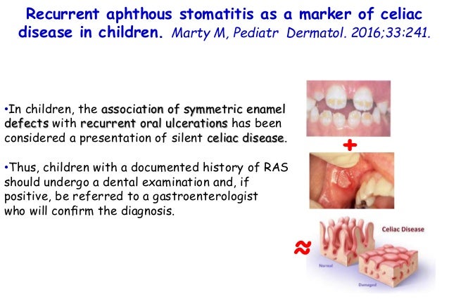 Recurrent aphthous stomatitis
