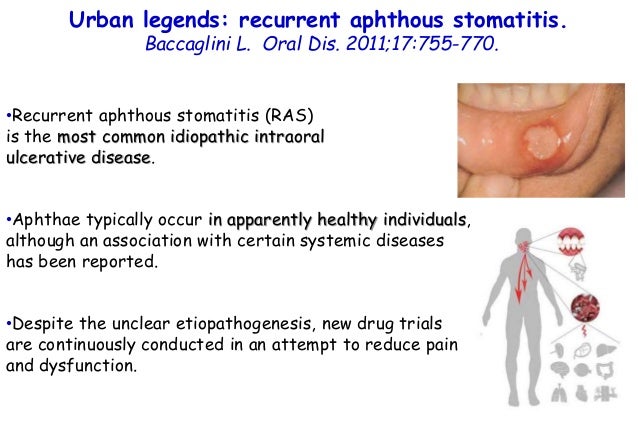 Aphthous Ulcer Causes