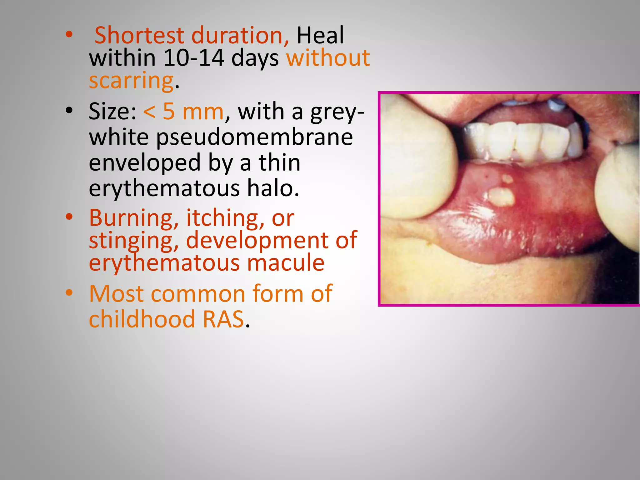 Allergic and Immunologic Diseases of Oral Cavity | PPTX