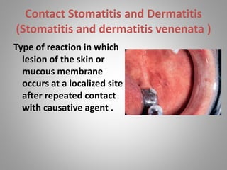 Allergic and Immunologic Diseases of Oral Cavity | PPTX