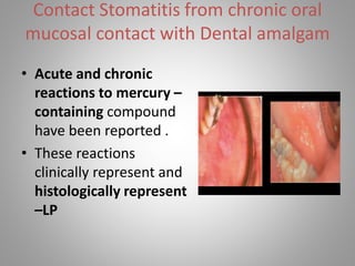 Allergic and Immunologic Diseases of Oral Cavity | PPTX