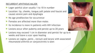 Comprehensive Seminar on Recurrent Aphthous Stomatitis: Causes, Types ...