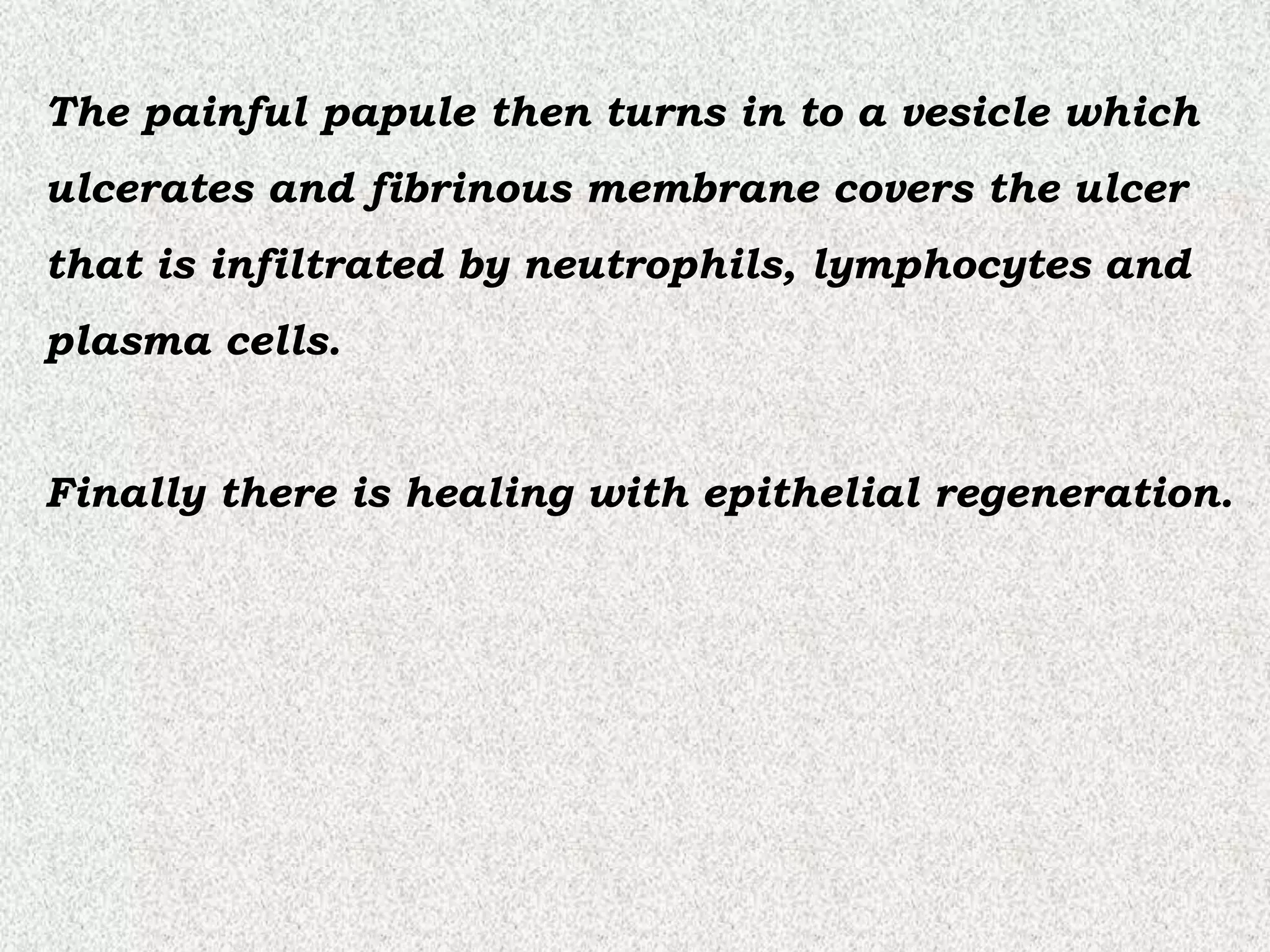 Recurrent aphthous ulcers (RAS).pptx