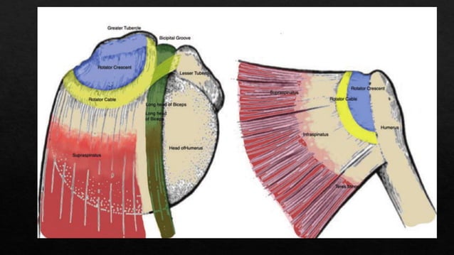 Recurrent Dislocation of Shoulder.pptx