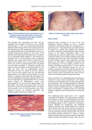 Single staged surgical procedure for recurrent incisional hernia with ...