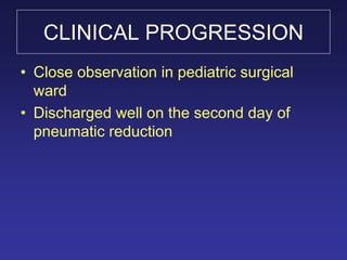 Recurrent Intussusception | PDF