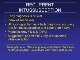 Recurrent Intussusception | PDF