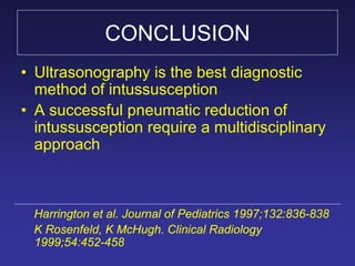 Recurrent Intussusception | PDF