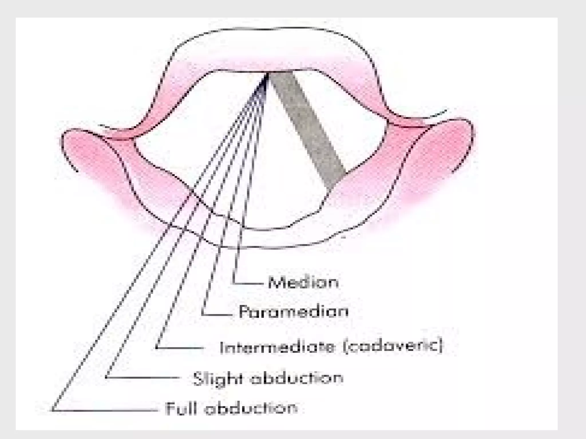 Recurrent laryngeal nerve paralysis | PPT