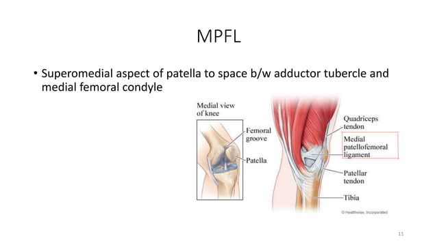 Recurrent Dislocation of patella | PPTX