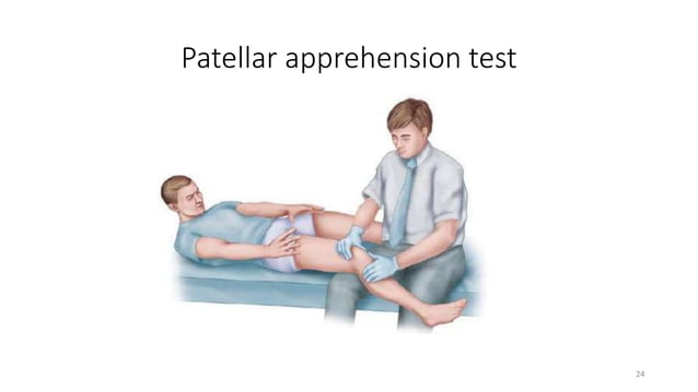 Recurrent Dislocation of patella | PPTX