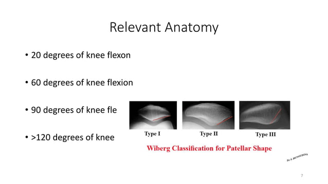Recurrent Dislocation of patella | PPTX
