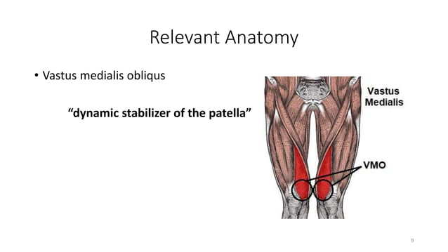 Recurrent Dislocation of patella | PPTX