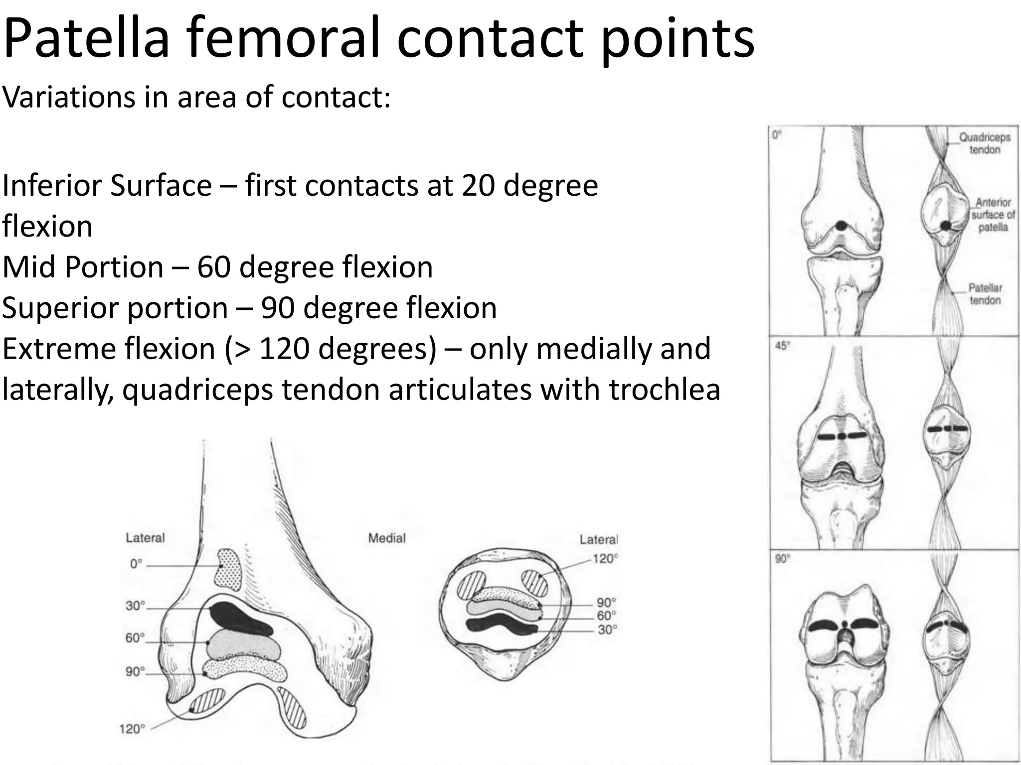 Recurrent patellar dislocation | PPTX