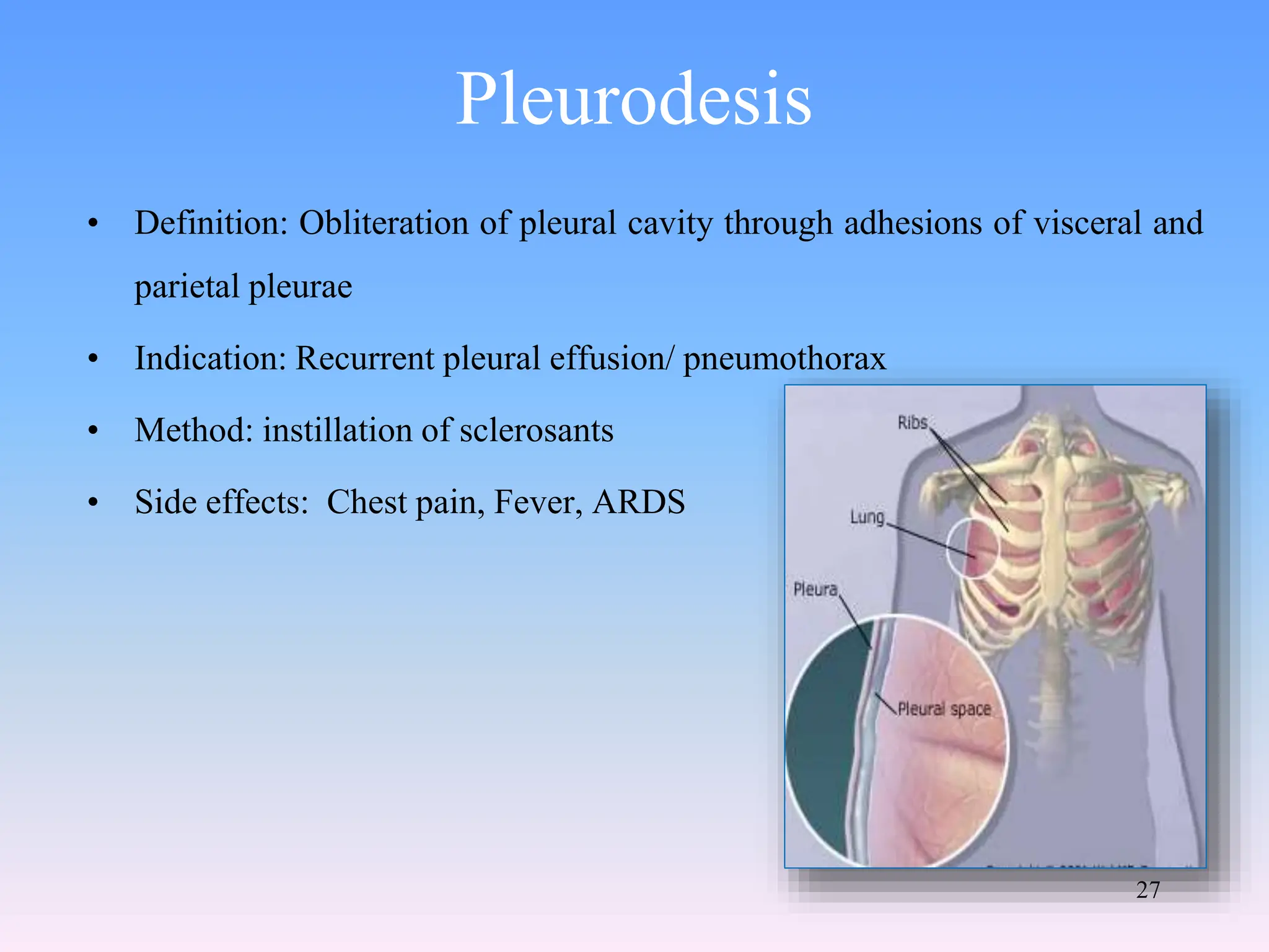 Recurrent Pneumothorax and Pleural Effusion Role of Pleuroscopy ...