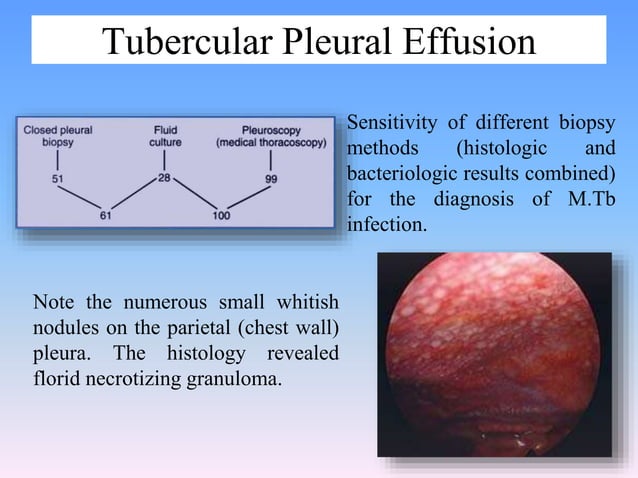 Recurrent Pneumothorax and Pleural Effusion Role of Pleuroscopy ...