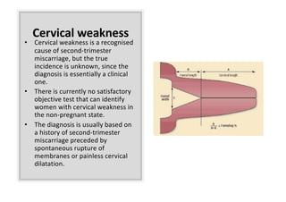 Recurrent pregnancy loss | PDF