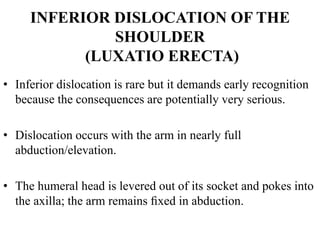 Recurrent shoulder dislocation | PPTX