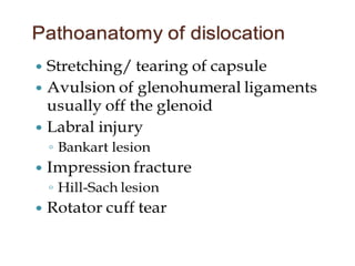 Recurrent shoulder dislocation | PPTX