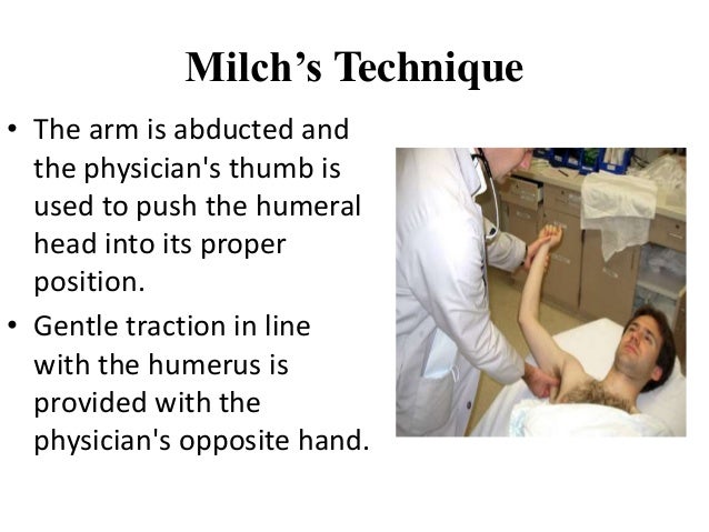 Recurrent shoulder dislocation