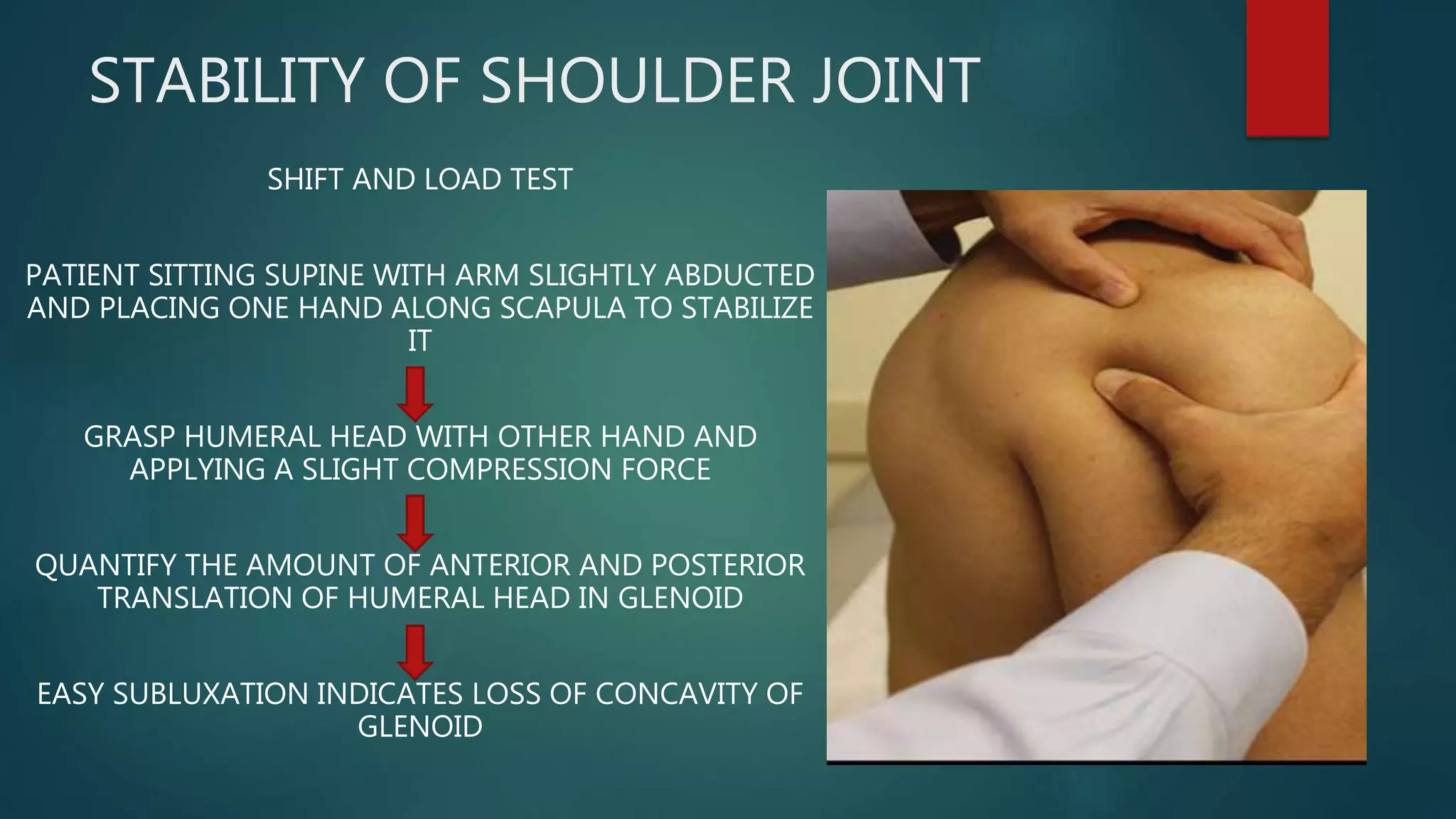 Recurrent shoulder dislocation and management | PPTX