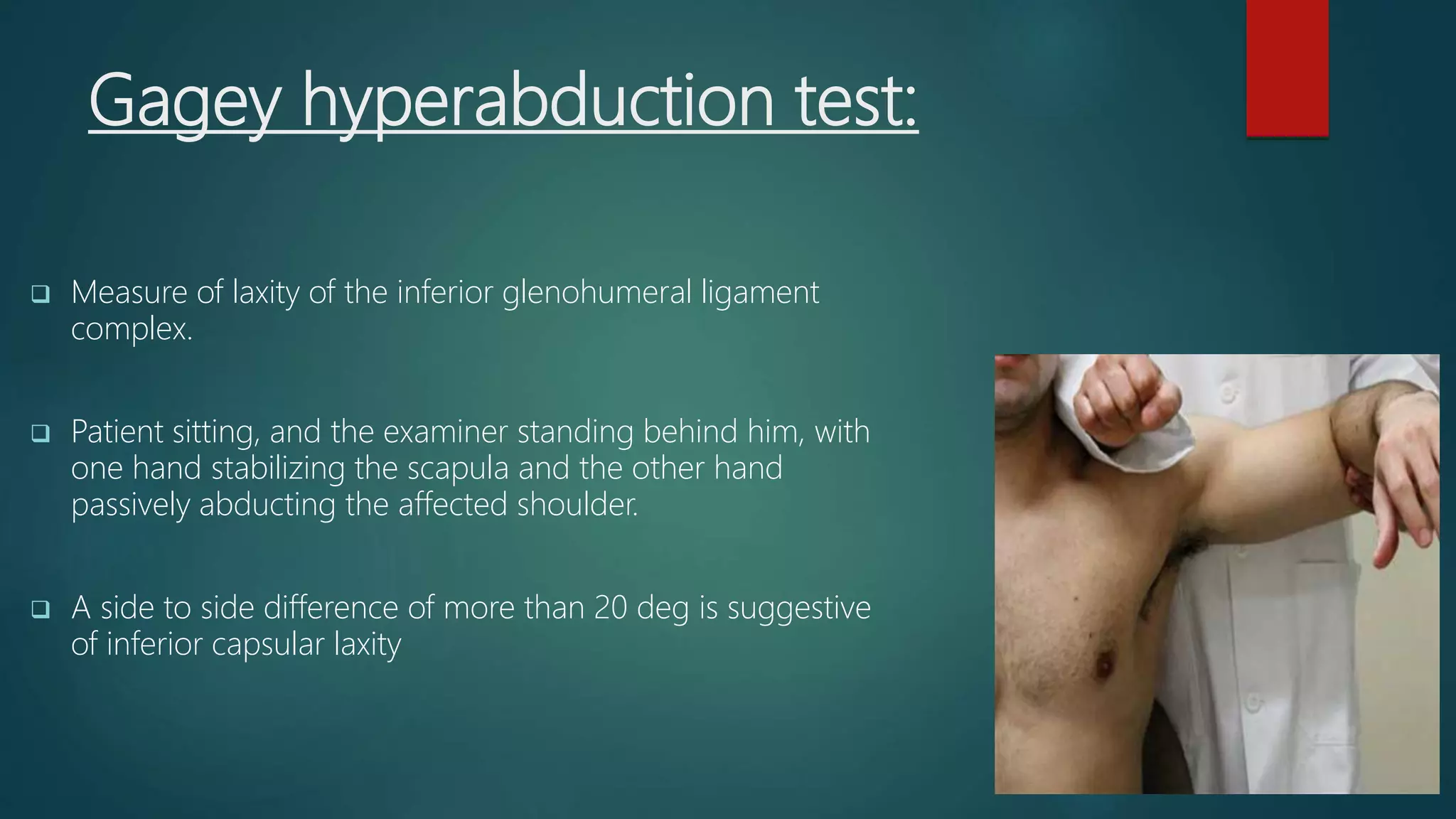 Recurrent shoulder dislocation and management | PPTX
