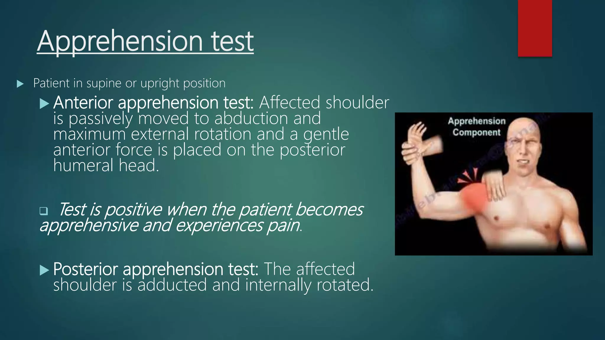 Recurrent shoulder dislocation and management | PPTX