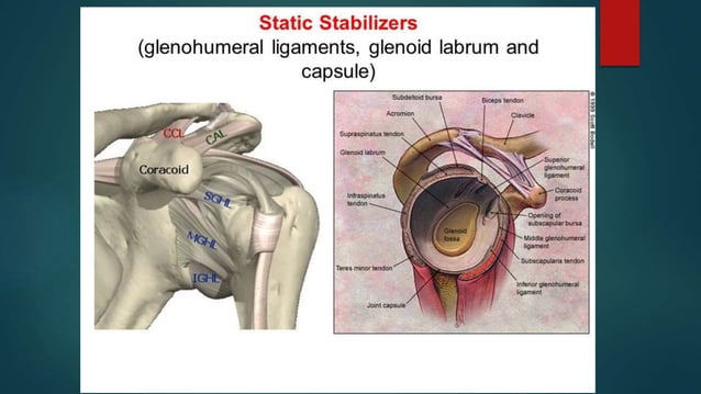 Recurrent shoulder dislocation and management | PPTX