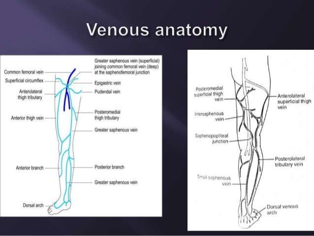 Recurrent varicose veins and its management