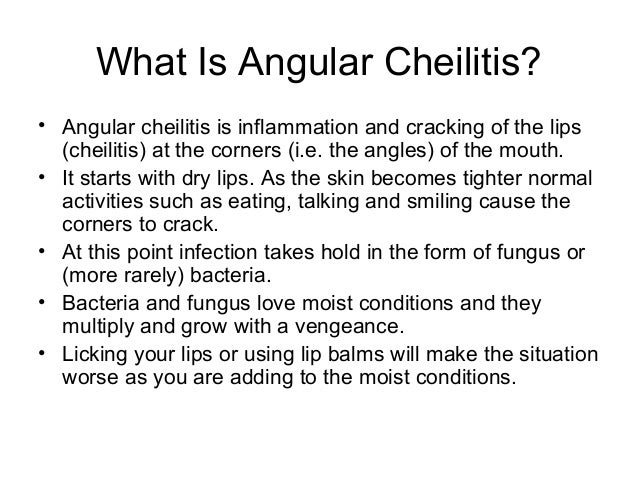 Recurring Angular Cheilitis