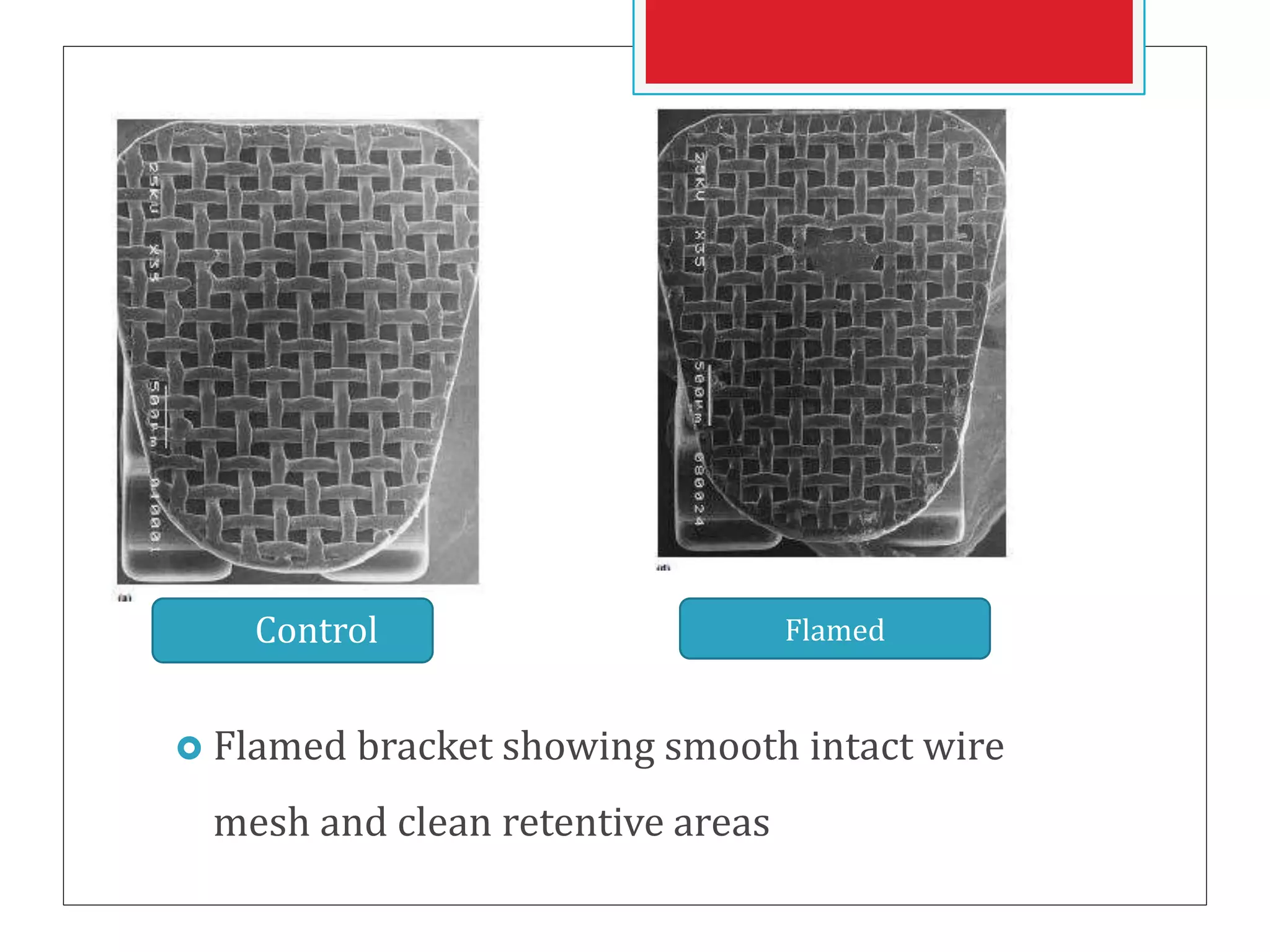 Recycling of orthodontic brackets | PPTX