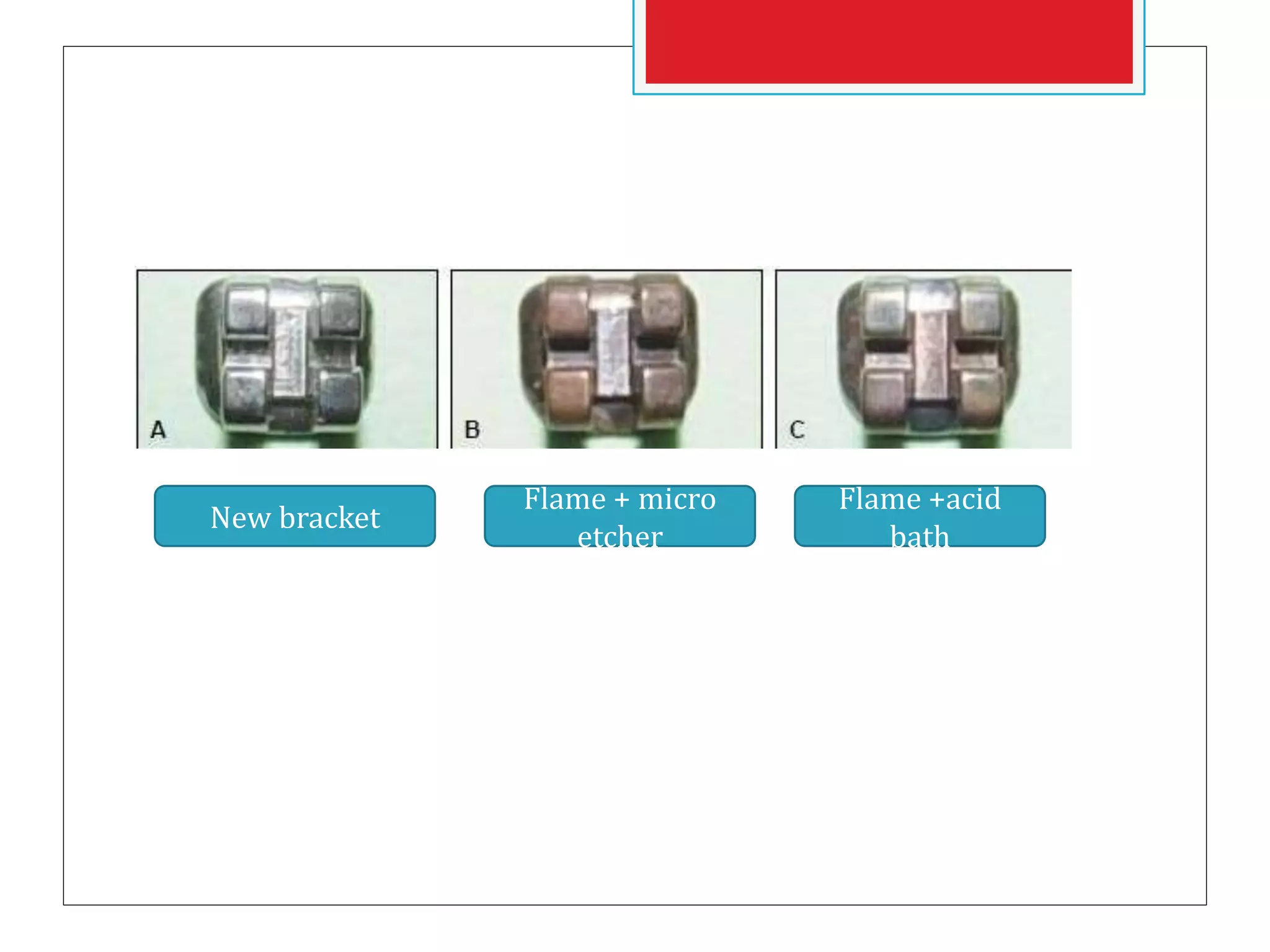 Recycling of orthodontic brackets | PPTX