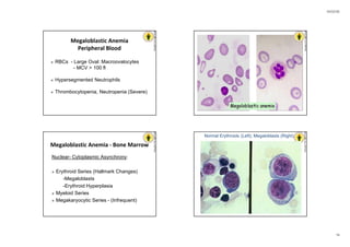 Red-blood-cell pathology notes with sketch | PPT