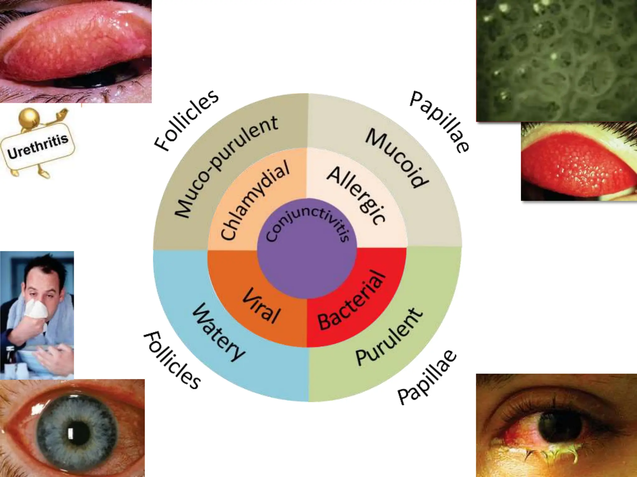 red-eye problems missan college of medicine | PPT