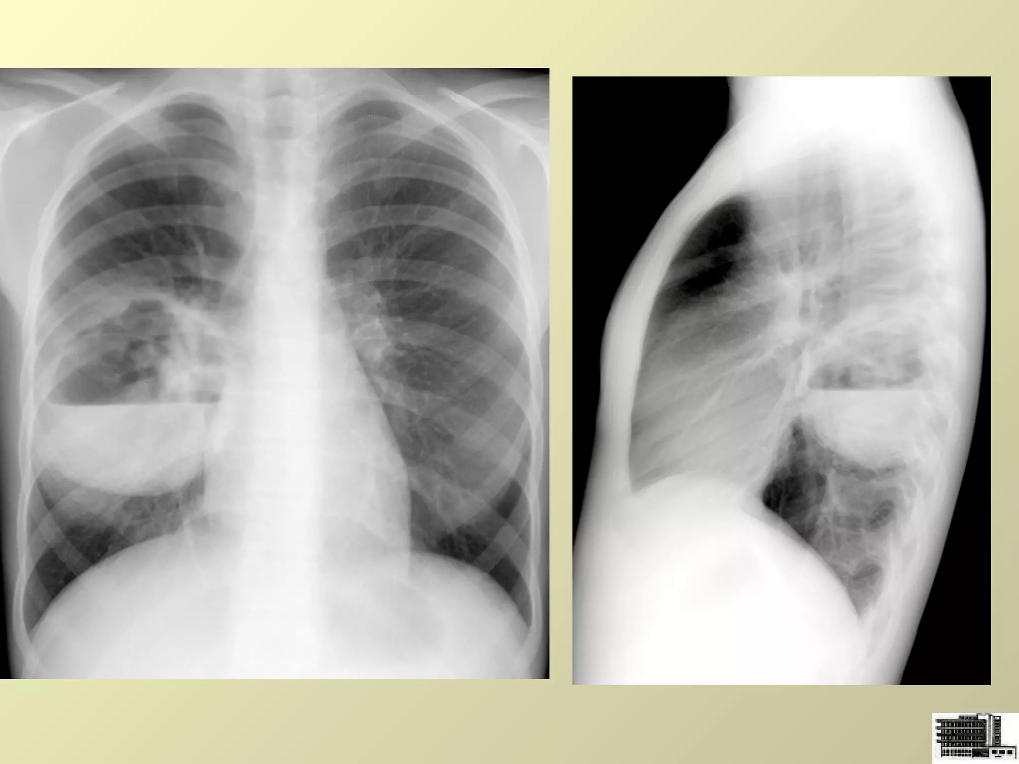 Redactarea unui buletin radiologic | PPT