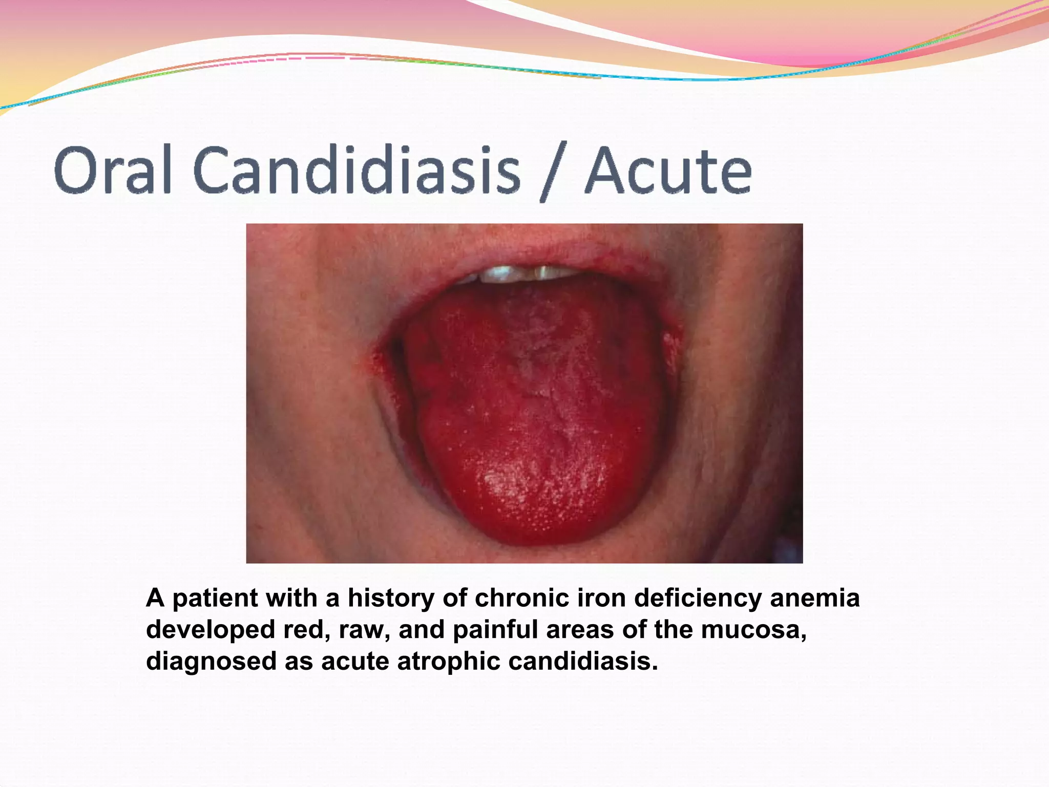Red and White Lesions | PDF