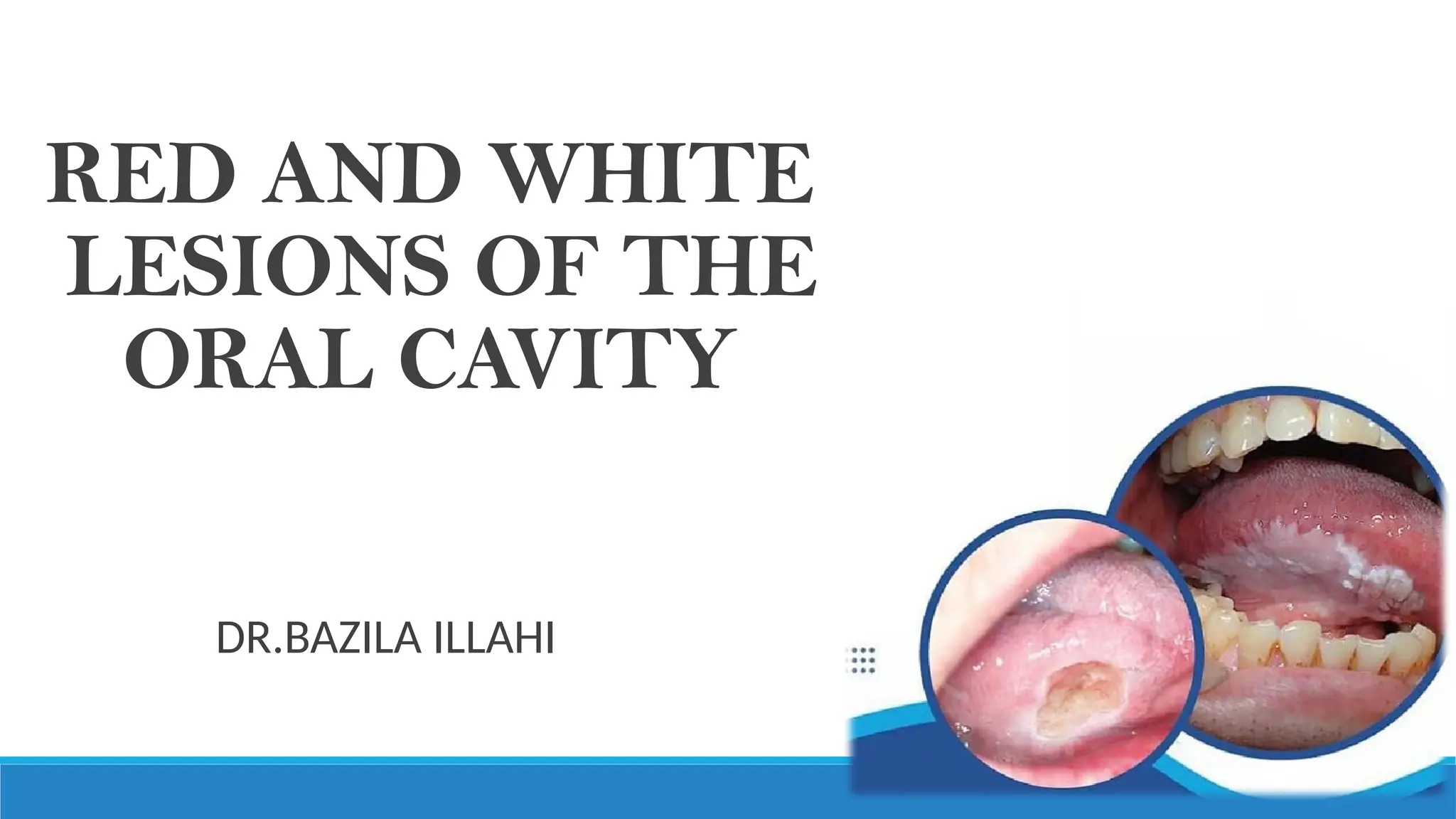 RED AND WHITE LESIONS 2-PART 2 RED LESIONS | PPTX