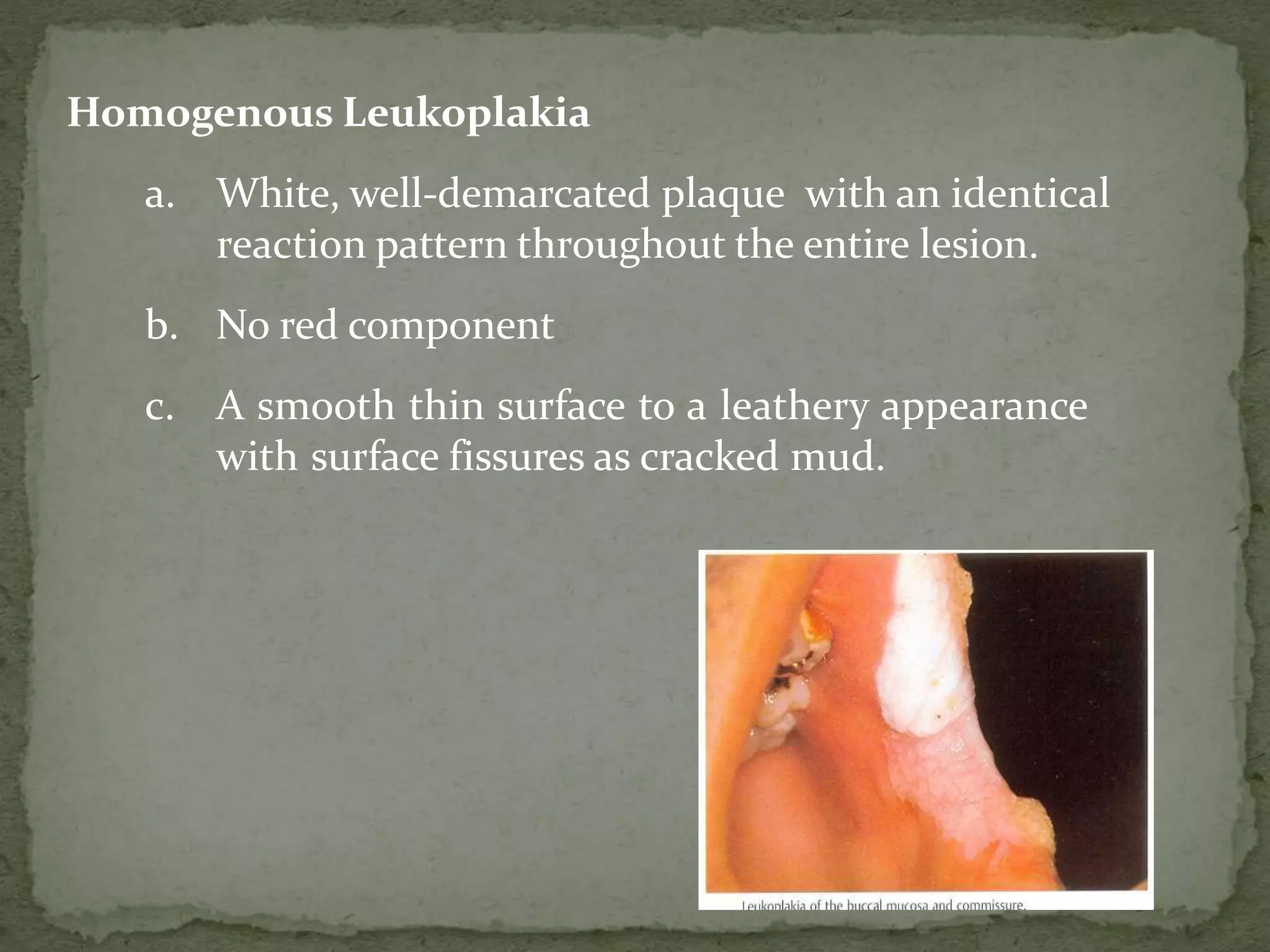 Red and White lesions Part 1 | PPTX