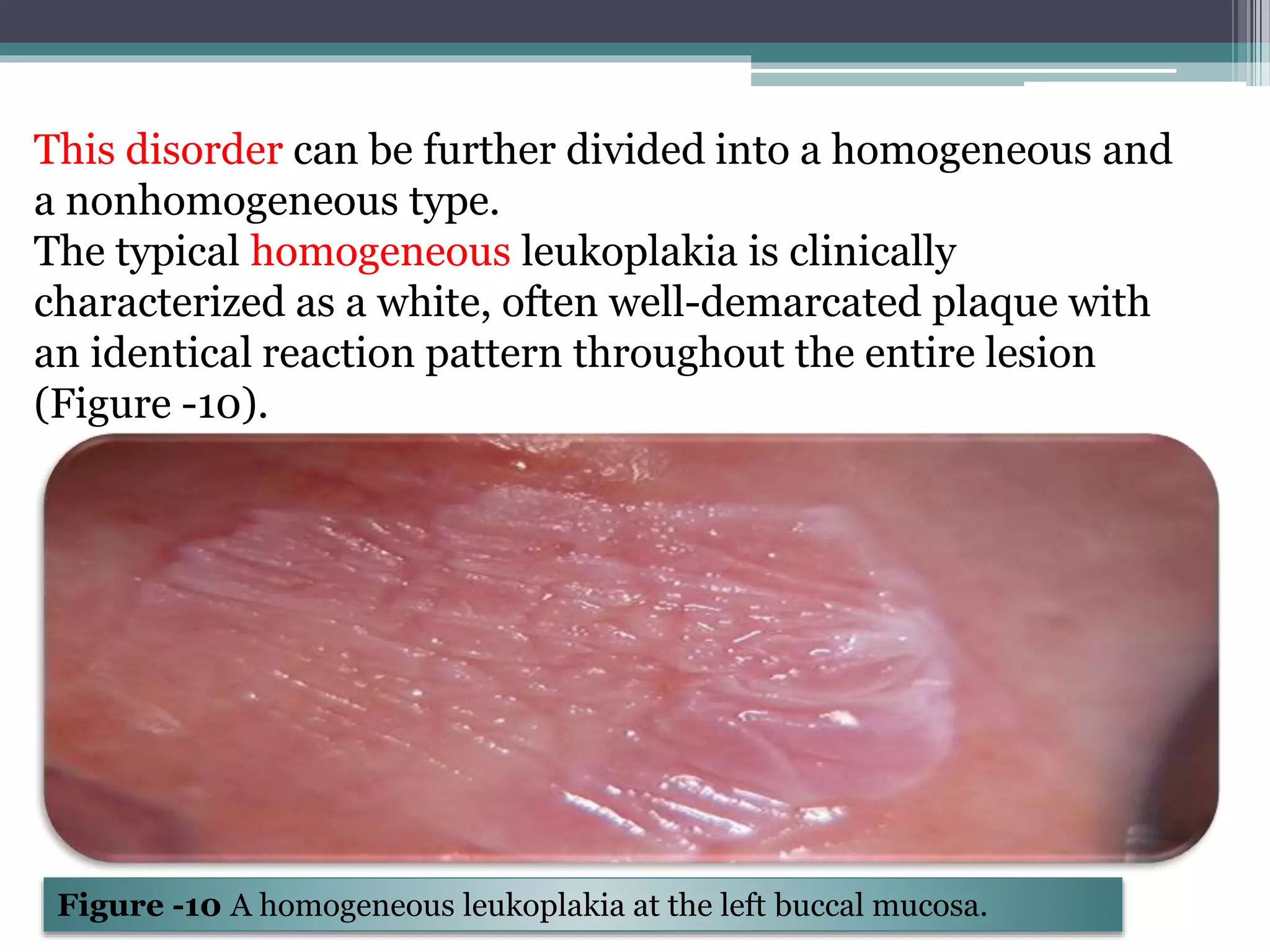 Red and White Lesions of the.pptx