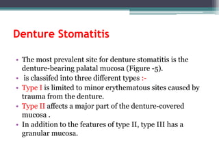Red and White Lesions of the.pptx