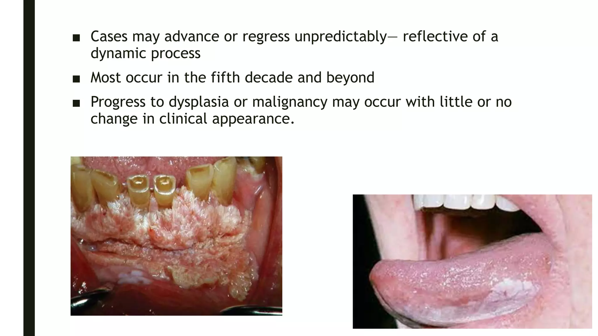 RED AND WHITE LESIONS OF THE ORAL MUCOSA.pptx