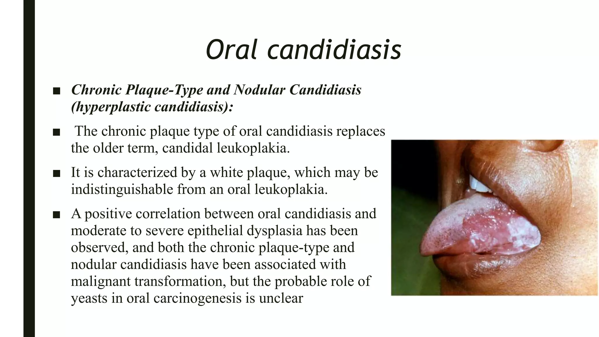 RED AND WHITE LESIONS OF THE ORAL MUCOSA.pptx