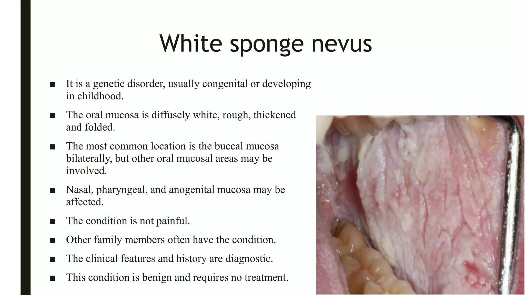 RED AND WHITE LESIONS OF THE ORAL MUCOSA.pptx